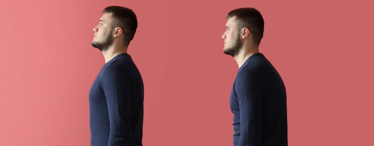 Muscle Imbalances: Causes, Effects, and PT Solutions